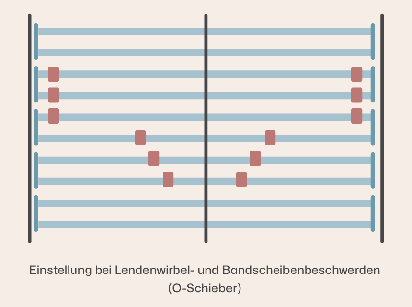 Verwunderlich Lattenrost Einstellen Lendenwirbel Schmerzen Bilder
